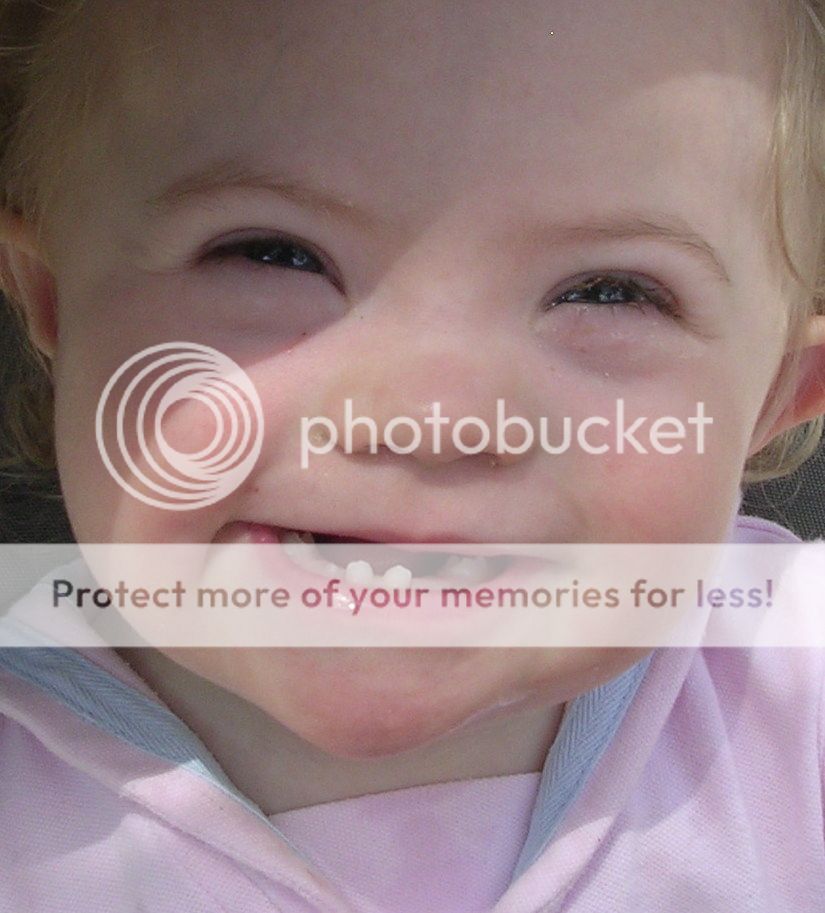 Translucency Teeth | BabyCenter